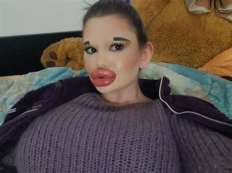 Big Lips Babe Telegraph