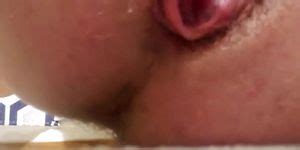 Stretched Put Asshole Prolapse Play Tnaflix