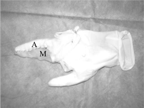 Appendix Model A Appendix M Mesoappendix Download Scientific Diagram