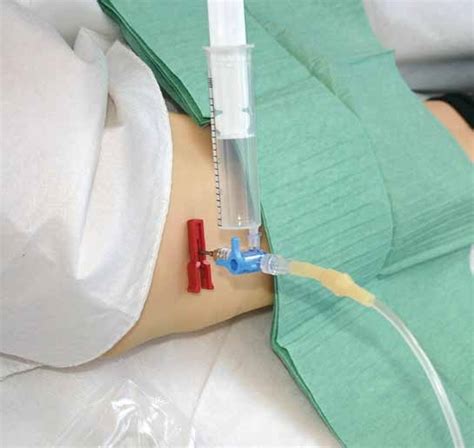 B I G Bone Injection Gun Pediatric Liveactionsafety