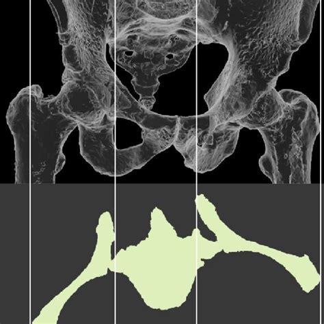 Pdf The Axial Pelvic Rotation Assessment Based On Pelvic Bones According To The Original
