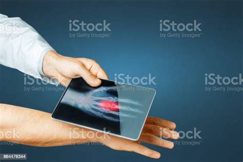 디지털 태블릿 의사가 손으로 환자의 손 의학 및 의료 개념 현대 X 선 기술 검사 X 레이에 대한 스톡 사진 및 기타 이미지 X 레이 건강관리와 의술 과학적 이미지화