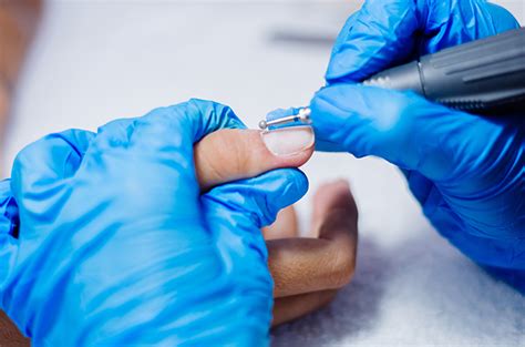 Nail Excision When Is It Necessary And What To Expect Kosmoderma