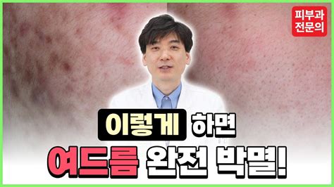 이걸 몰라서 여드름 계속 생기는 겁니다 알려주기 아까운 여드름 치료 방법을 피부과전문의가 알려드립니다 Youtube