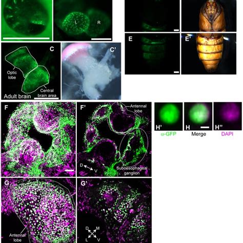 Visualization Of Cellular Position By Nuclear Localizing Gfp
