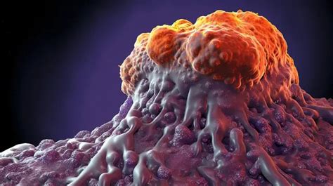 붉은 암세포 세포 Std 그림 여자 여성 여자 배경 일러스트 및 사진 무료 다운로드 Pngtree