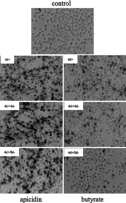Benzidine Staining Of K562 Cells Treated With Butyrate And Apicidin Download Scientific