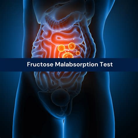 Fructose Malabsorption Test Christine Barnes Complex Case Naturopath And Nutritionist