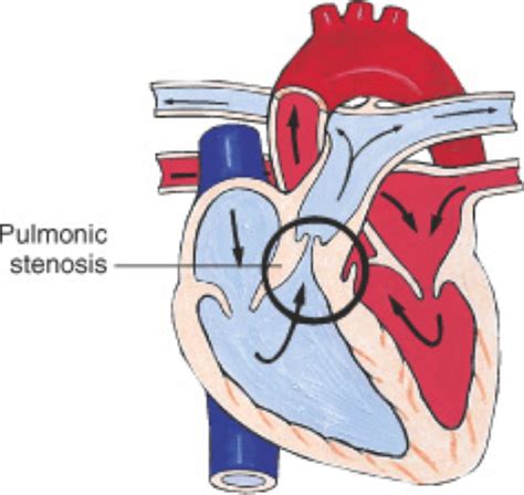 Week 3 Flashcards Quizlet
