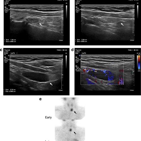 Preoperative Localization In Pediatric Primary Hyperparathyroidism Download Scientific Diagram