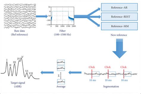 The Schematic Diagram Of Abr Acquisition And Processing From Raw Eeg