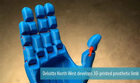 3d printed prosthetic arm