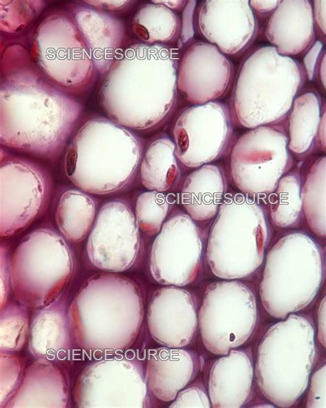Collenchyma Tissue Under A Microscope Stock Image Science Source Images