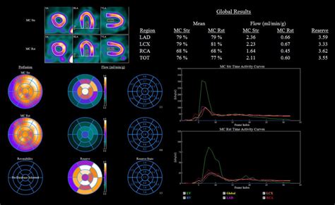 Spectrum Dynamics Medical Ltd D Spect