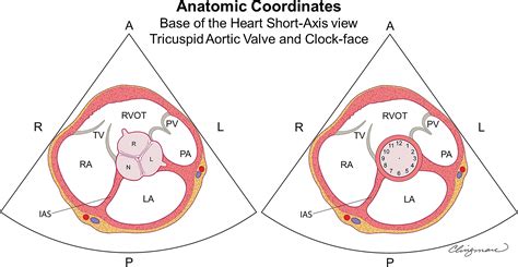 Normal Aortic Valve Anatomy