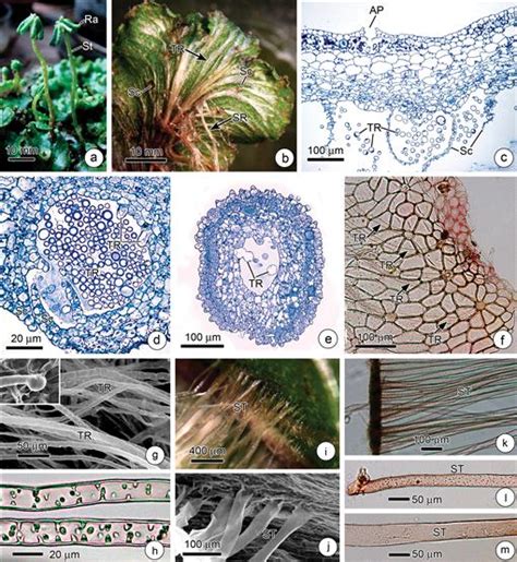 Formation And Development Of Rhizoids Of The Liverwort Marchantia Polymorpha1