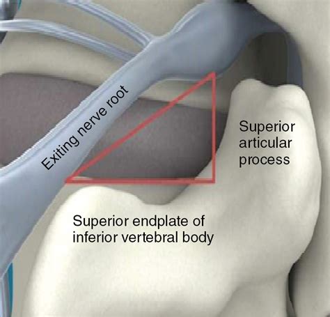 Anatomicphysiologic Indirect Decompression Anesthesia Key