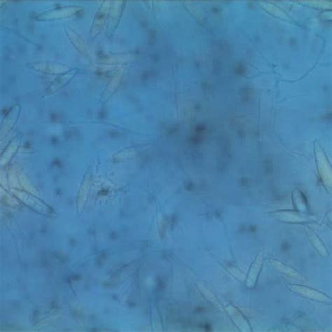 Microscopic Examination Of The Morphology M Gypseum Fusiform