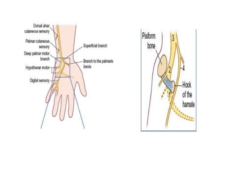Ulnar Nerve