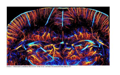 Ultrasound Localization Microscopy And Super Resolution A State Of The Art