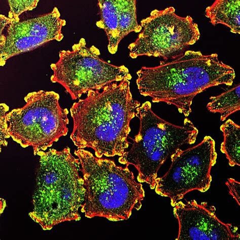 Tool Can Accurately Detect Single Nucleotide Variations In Individual