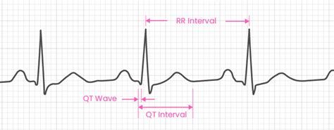 Rr Interval Skillstat
