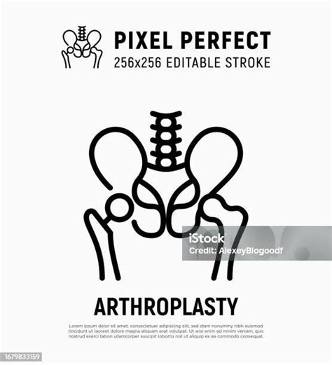 관절 성형술 얇은 선 아이콘 인공 관절 관절을 복원하는 수술 절차 관절염 픽셀 완벽 편집 가능한 스트로크 벡터 그림입니다 건강관리와 의술에 대한 스톡 벡터 아트 및 기타