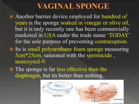 Methods Of Family Limiting And Spacing Methods 1 PPTX