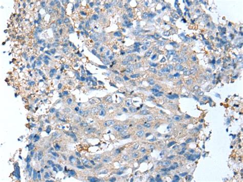 Anti Dcx Doublecortin Antibody Rabbit Anti Human Polyclonal Lsbio