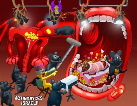 Actinomyces Israelii Video Causes And Meaning Osmosis