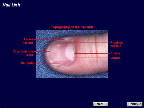 Onychodermal Band