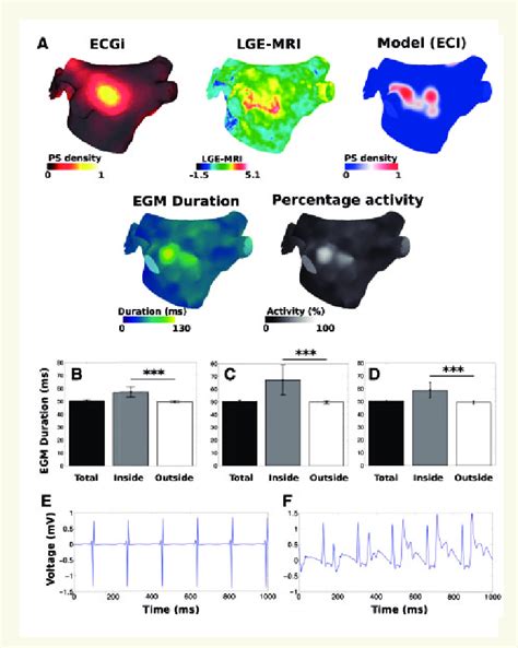 Increased Electrogram Fractionation Is Seen In Areas Corresponding To Download Scientific
