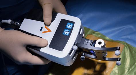 Accelus Gains 510 K Clearance Of Remi Robotic Navigation