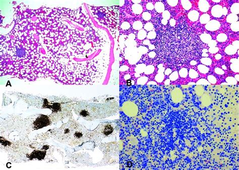 Role Of The Classical And Terminal Complement Pathways In Cold Download Scientific Diagram