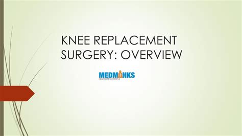 Ppt Knee Replacement Surgery Overview Powerpoint Presentation Free