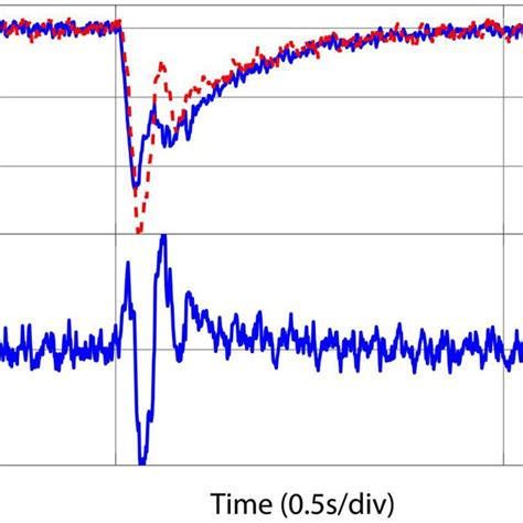speed estimation based on sogi at 1000 r min under the parameter error
