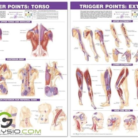 Trigger Points Chart Set Of 2 Gulfphysio Uaes Online