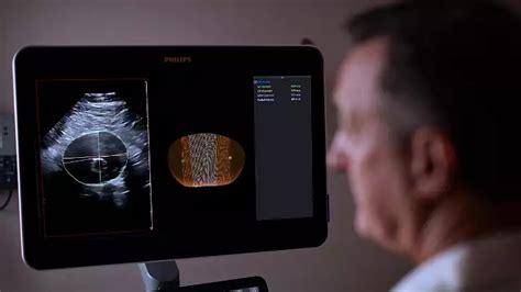 Improved Diagnostic Confidence Patient Experience Philips