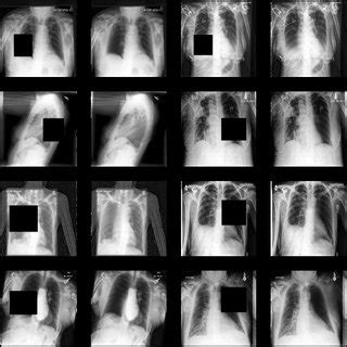 Visualization Of Inpainting Self Supervised Pre Training Model Output Download Scientific