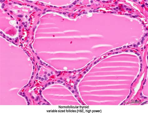 Pathology Outlines Histology
