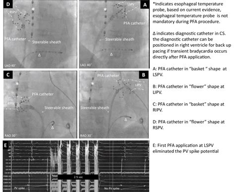 Example Of Pfa For Each Pv With Different Configurations Download Scientific Diagram