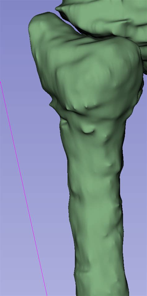 Fill Between Slices Makes Troubles Support 3d Slicer Community