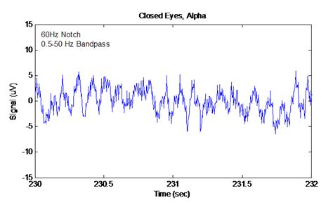 Eeg Hacker Waveforms From Homemade Electrodes
