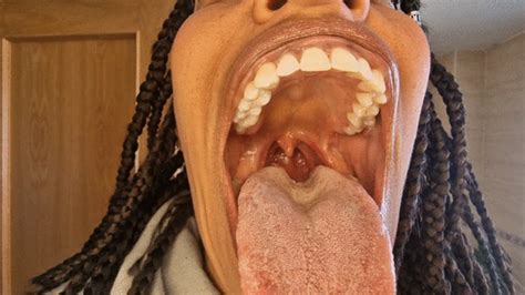 My UVULA Mushrooms And Cutter Golden Lace Clips Sale My UVULA Mushrooms And Cutter Golden Lace Clips Sale