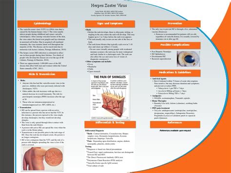 Shingles Poster Pdf Animal Diseases Viral Diseases