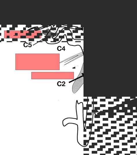 Next Anki Card Not Displaying Help Anki Forums