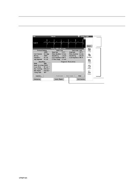 Medtronic 2090 Programming Guide