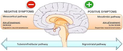 Schizophrenia Brain Dopamine