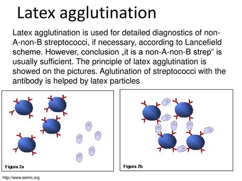 Tracing The Culprit Part Two Streptococcus Ppt Download