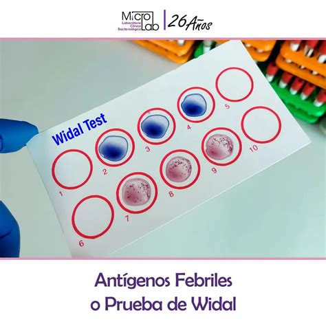 𝐌𝐈𝐂𝐑𝐎𝐋𝐀𝐁 𝐋𝐚𝐛𝐨𝐫𝐚𝐭𝐨𝐫𝐢𝐨 𝐜𝐥í𝐧𝐢𝐜𝐨 Los Antígenos Febriles O ”prueba De